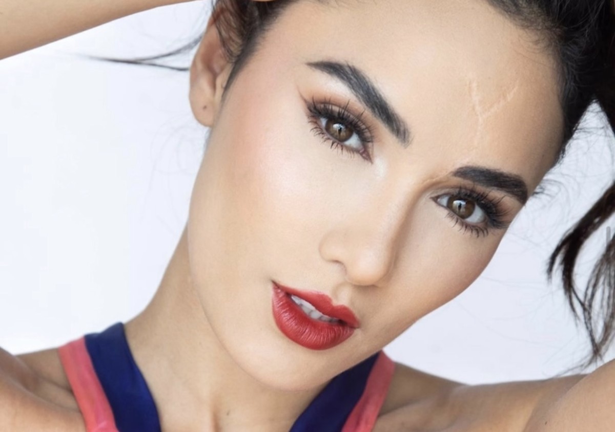 I love my scars, they tell my story - Miss World Mexico